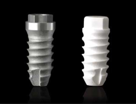 Implant Materials (Dental Implants): What Are Implants Made From ...